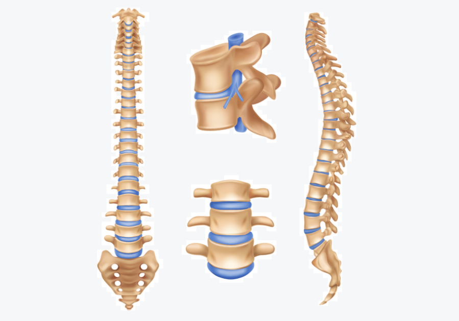 Co je spondylóza a jak se léčí?